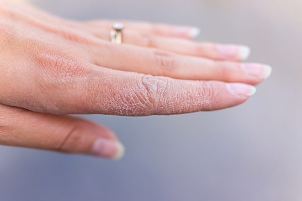 Diabetes Symptoms On The Skin | The 9 Signs Of Diabetes