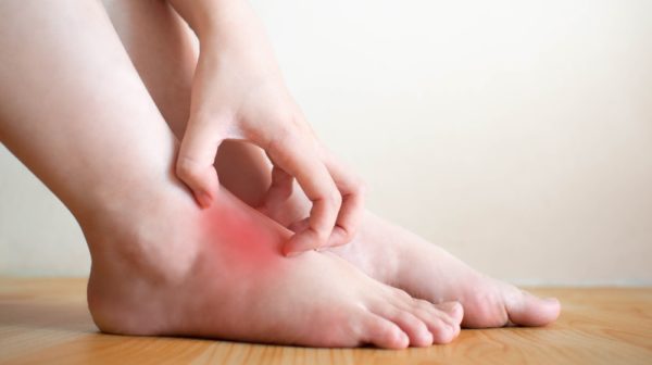 Diabetes Symptoms On The Skin | The 9 Signs Of Diabetes